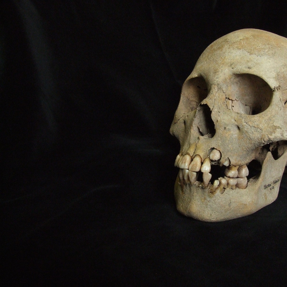 Ancient teeth from Siberia rewrite the plague’s timeline, dating back ...